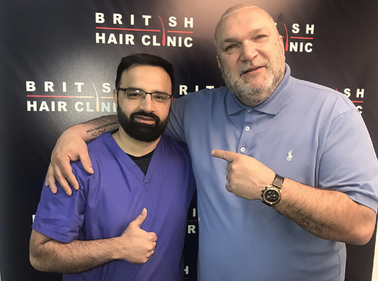 Neil Razor Ruddock Hair Transplant Treatment - British Hair Clinic